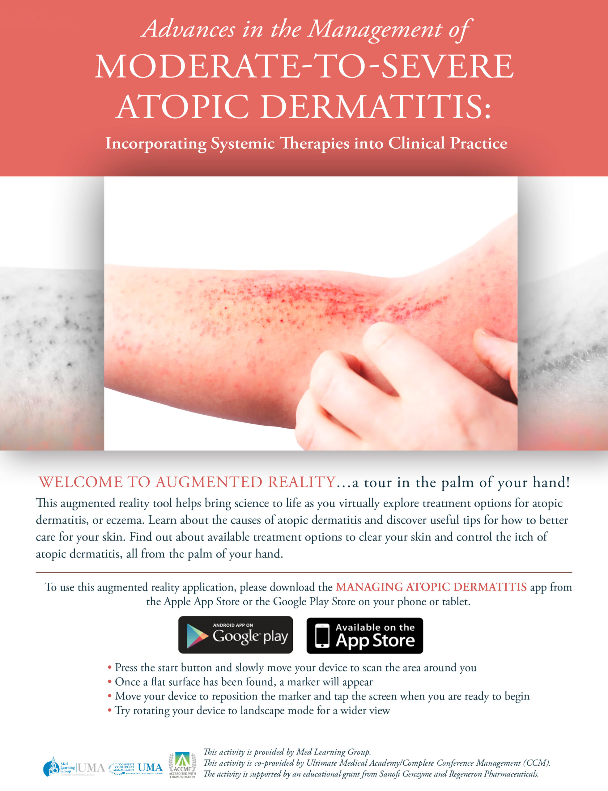 Advances in the Management of Moderate-to-Severe Atopic Dermatitis ...